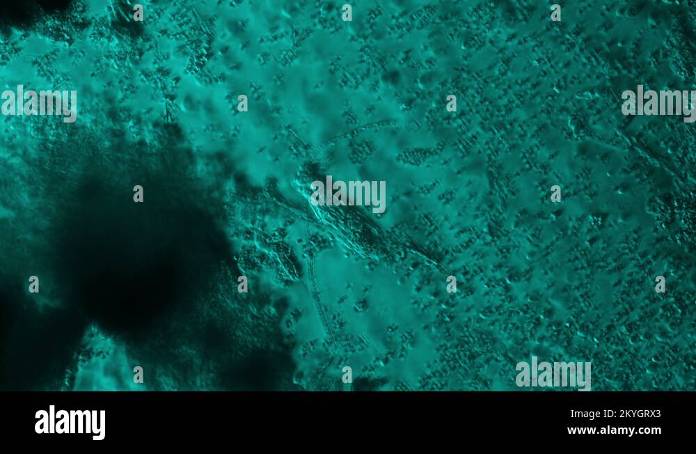 Protozoan Rotifer Feeding 400x Magnification Phase Microscope Stock ...