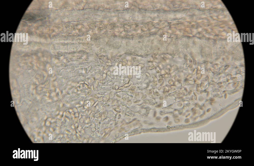 movement of the blood of a fish embryo, through transparent vessels ...