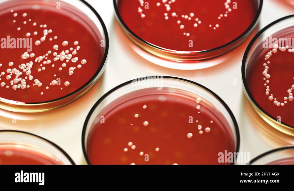 Staphylococcus agar Stock Videos & Footage - HD and 4K Video Clips - Alamy