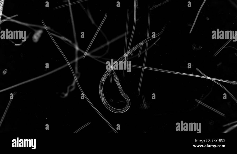 nematode worm of an unknown kind, with a strange oral part, under a microscope Stock Video ...
