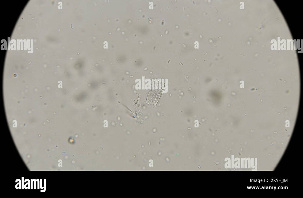 Ciliate protists Stock Videos & Footage - HD and 4K Video Clips - Alamy