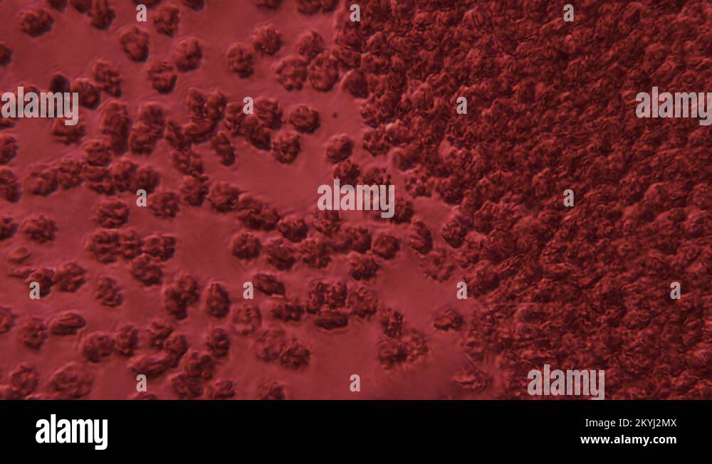 Coagulation Stock Videos & Footage - HD and 4K Video Clips - Alamy