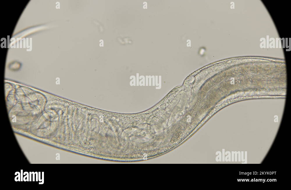 The female roundworm Turbatrix aceti gave birth to two nematodes formed at once Stock Video ...