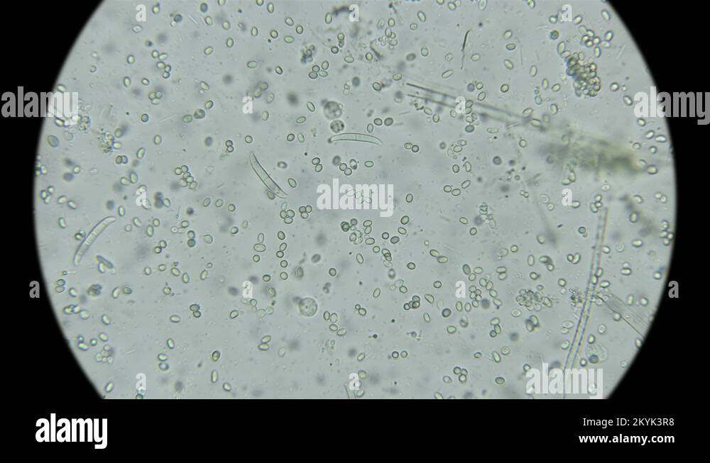 Penicillin fungus Stock Videos & Footage - HD and 4K Video Clips - Alamy