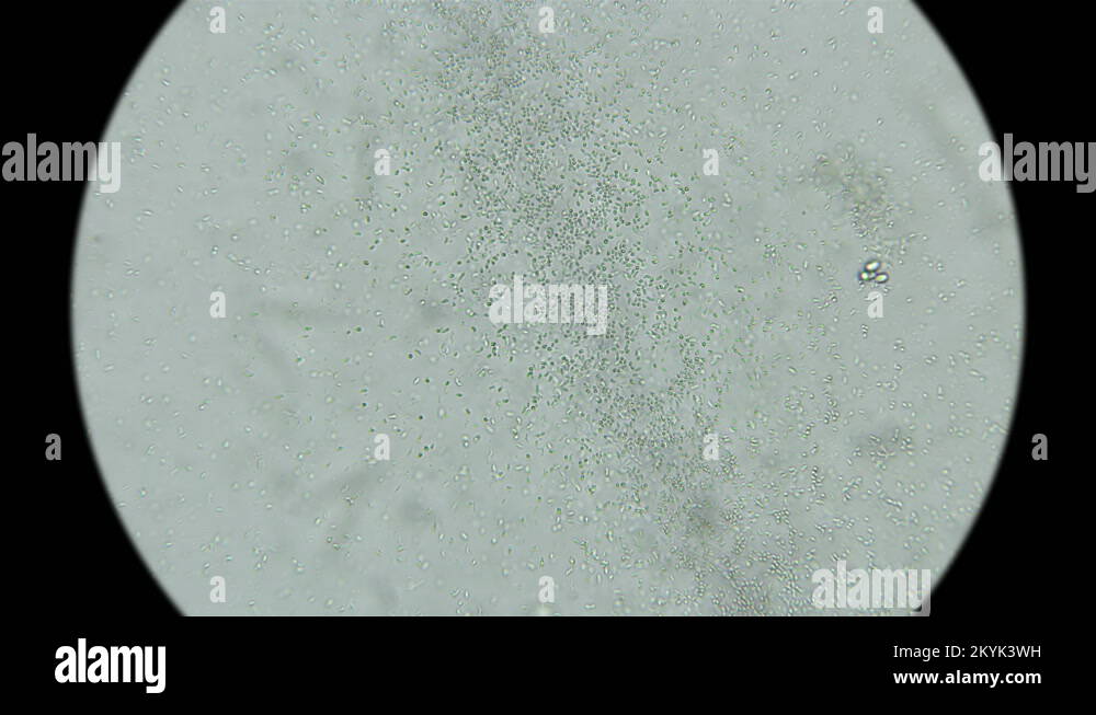 a drop of dirty water with a lot of bacteria and microorganisms Stock ...