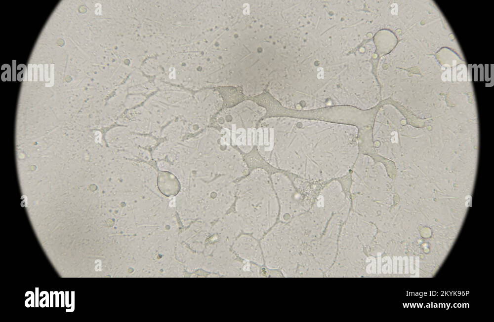 colony of rod-shaped bacteria appearing in decaying organisms Stock ...