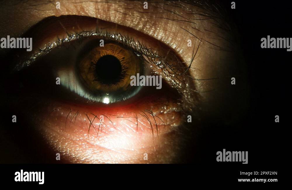 Disgustingly close-up view of eye lit by a flashlight in total darkness ...