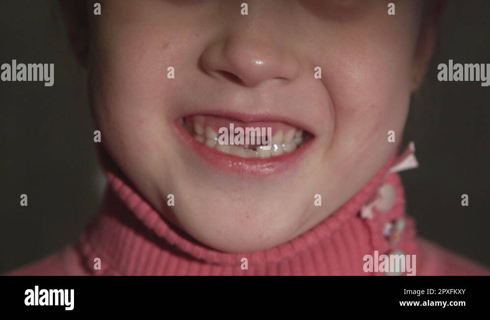 No front teeth Stock Videos & Footage - HD and 4K Video Clips - Alamy