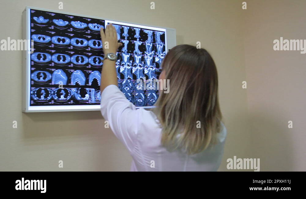 A Doctor hold in her hands MRI and CT scanns snapshot Stock Video ...