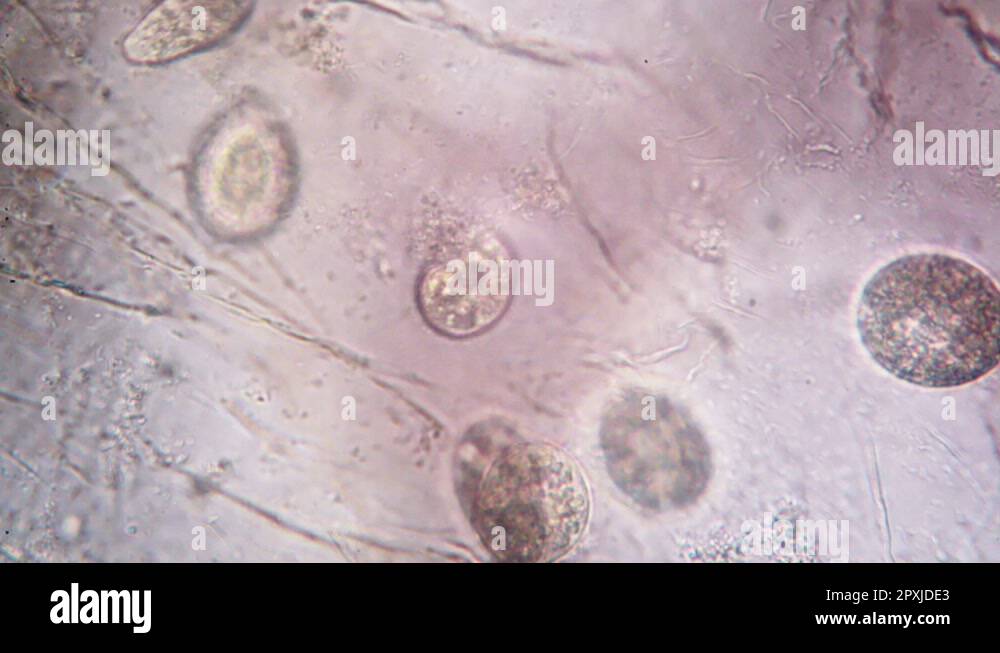 Microscopic animals Stock Videos & Footage - HD and 4K Video Clips - Alamy