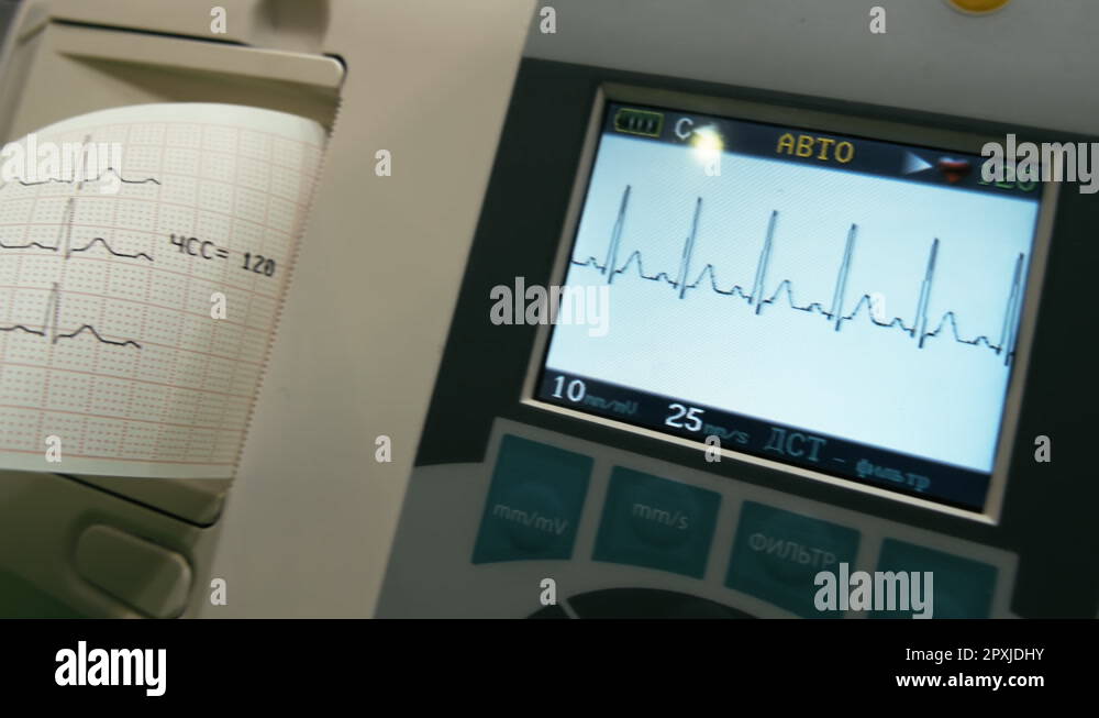 Monitoring heart ecg Stock Videos & Footage - HD and 4K Video Clips - Alamy