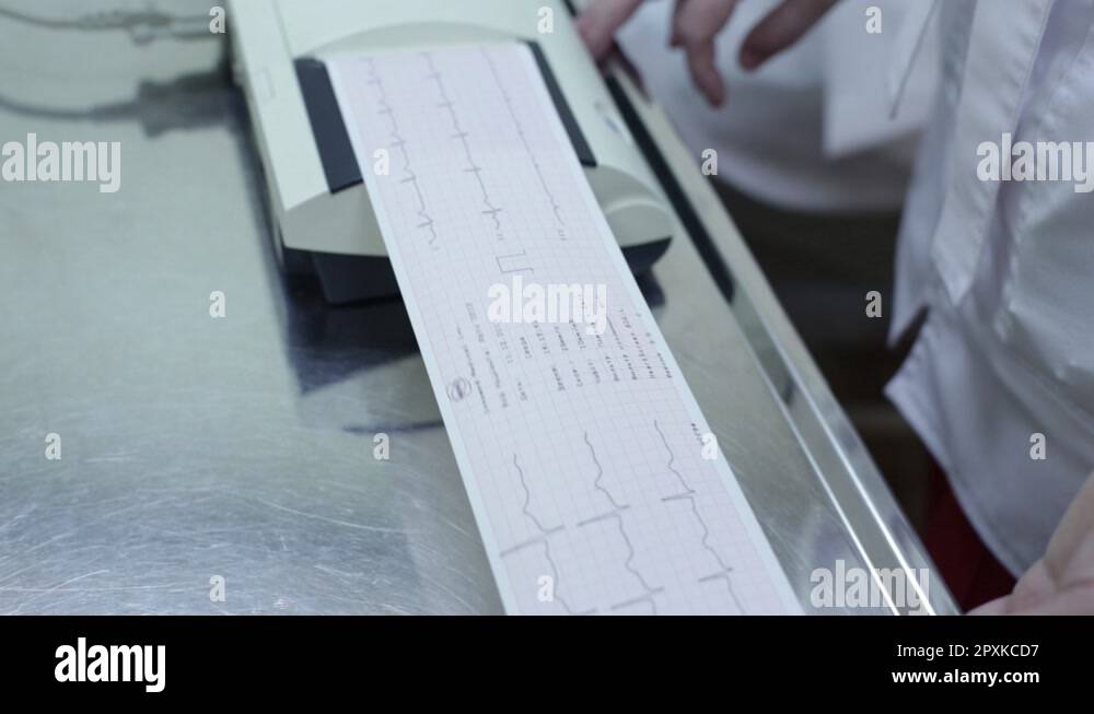 Electrocardiography test Stock Videos & Footage - HD and 4K Video Clips ...