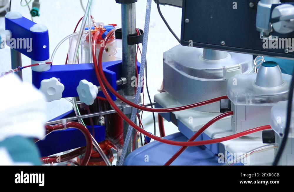 Cardiopulmonary Bypass Machine Heart Lung Stock Videos And Footage Hd And 4k Video Clips Alamy