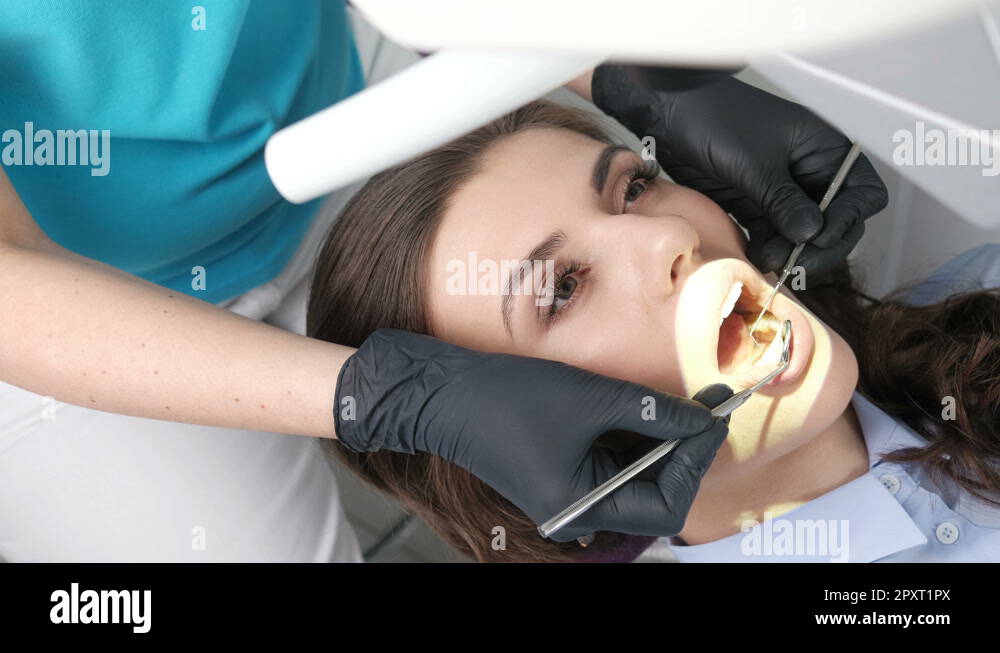 Dentist working on patient's teeth in a real dental surgery Stock Video ...