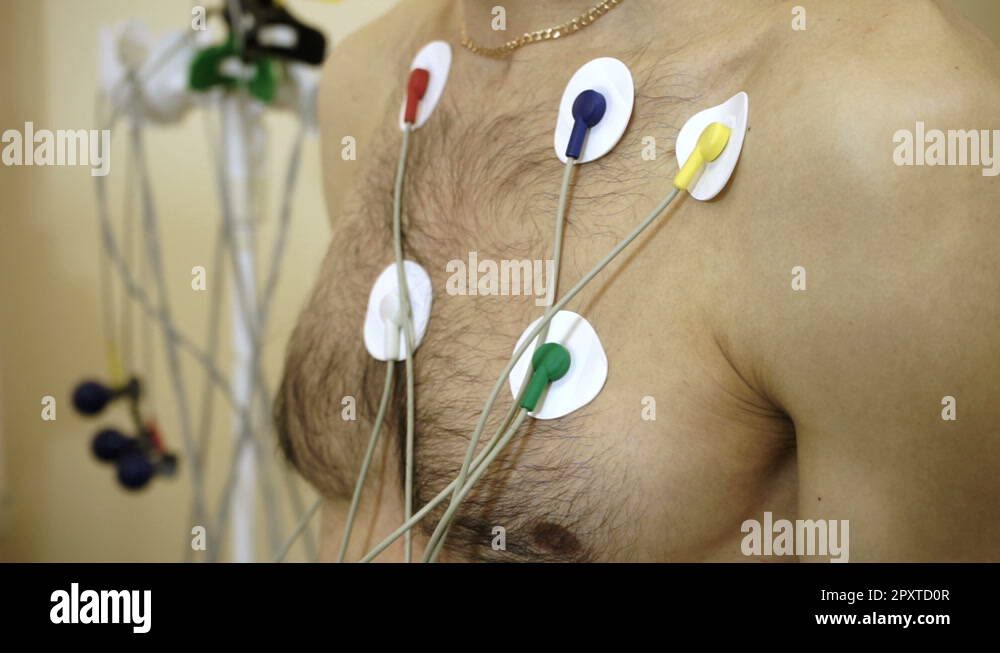 Holter monitor Stock Videos & Footage - HD and 4K Video Clips - Alamy