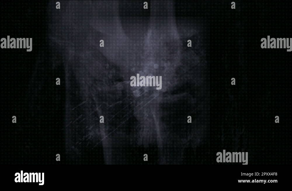X-ray medical scientific research,body health bones Pet-CT big-data ...