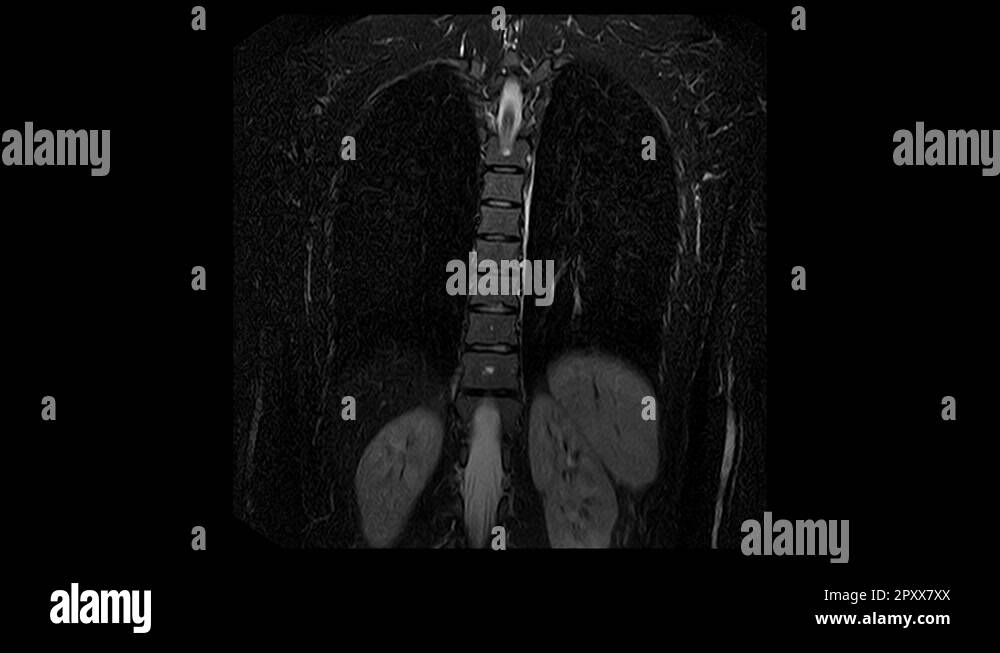Computed Medical Tomography MRI Upscaled Scan of Healthy Young Female ...
