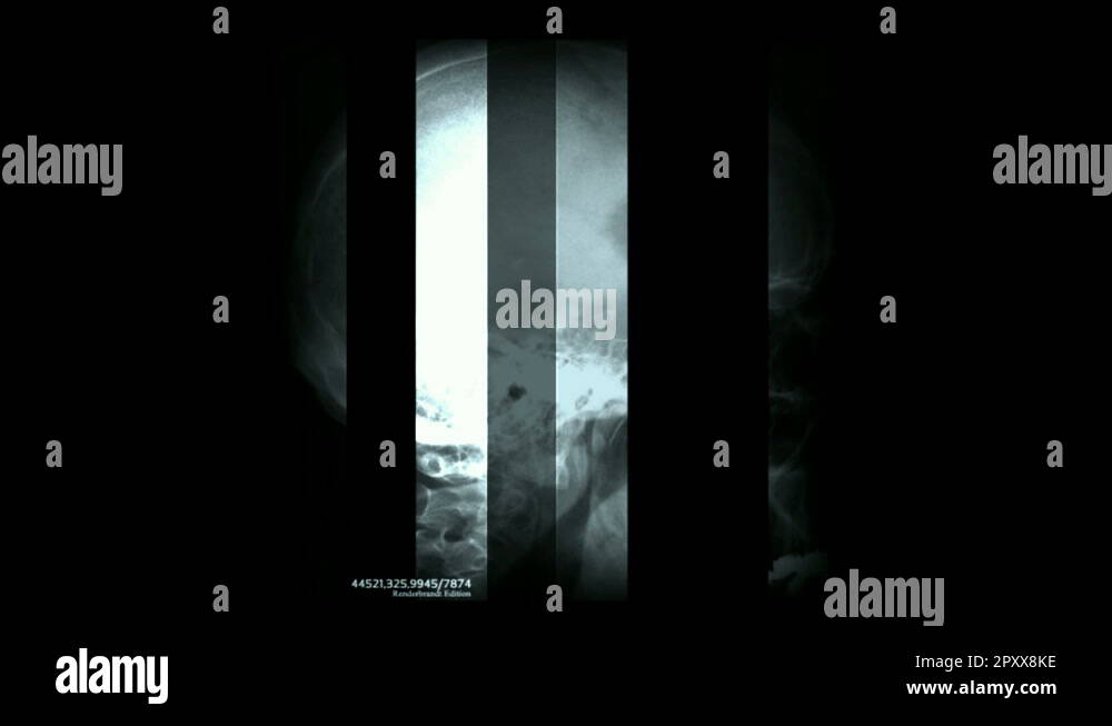 Human head bone skeleton skull X-ray scan,medical research body health ...