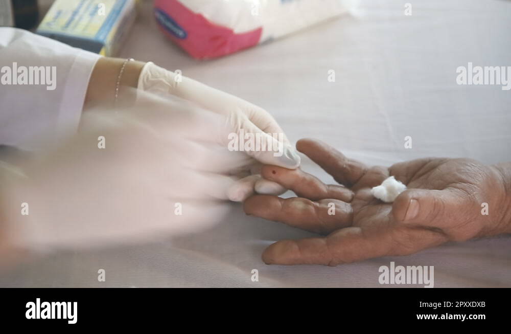 Capillary blood sampling Stock Videos & Footage - HD and 4K Video Clips ...