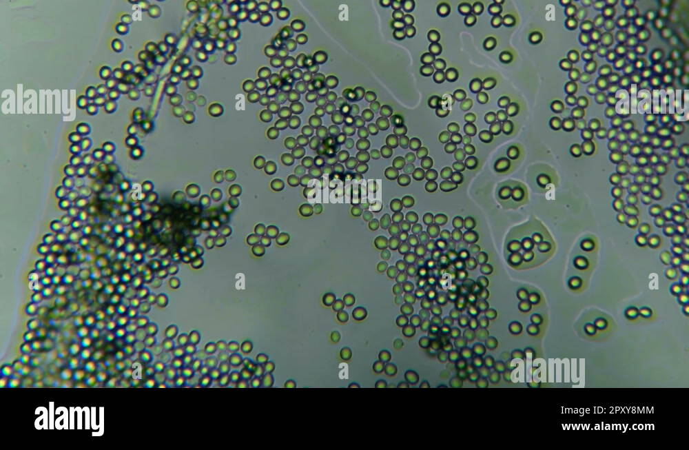 Bread mold under microscope Stock Videos & Footage - HD and 4K Video Clips - Alamy