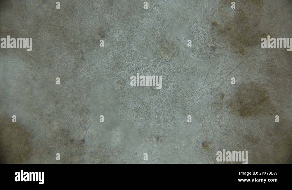 Decomposition bacteria Stock Videos & Footage - HD and 4K Video Clips - Alamy