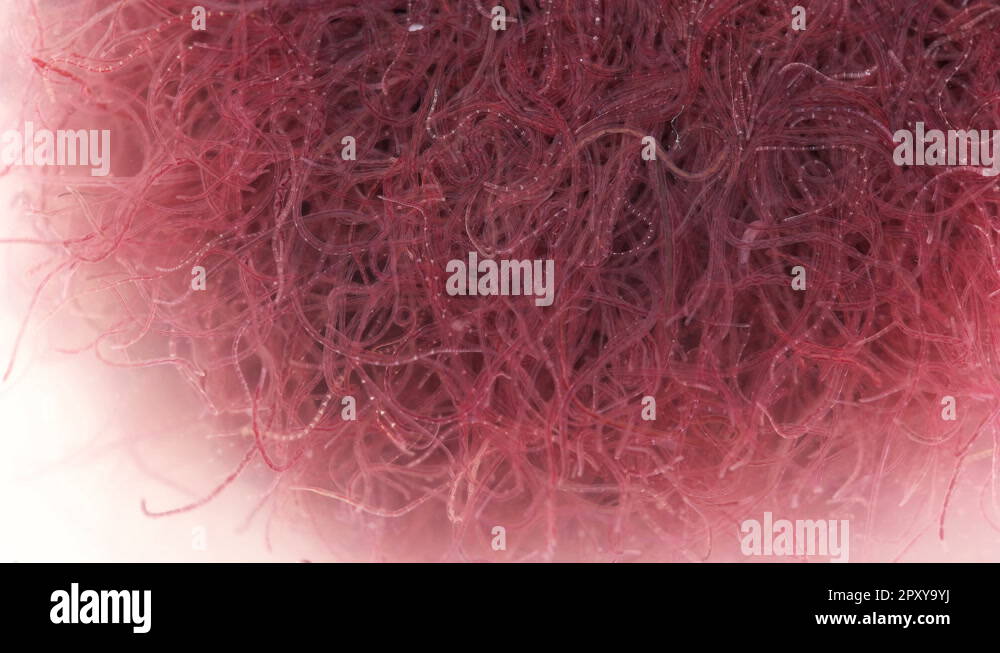 Annelida segmented worms Stock Videos & Footage - HD and 4K Video Clips ...