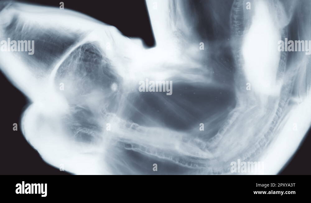 a transparent larva under the microscope,with internal organs,like an ...