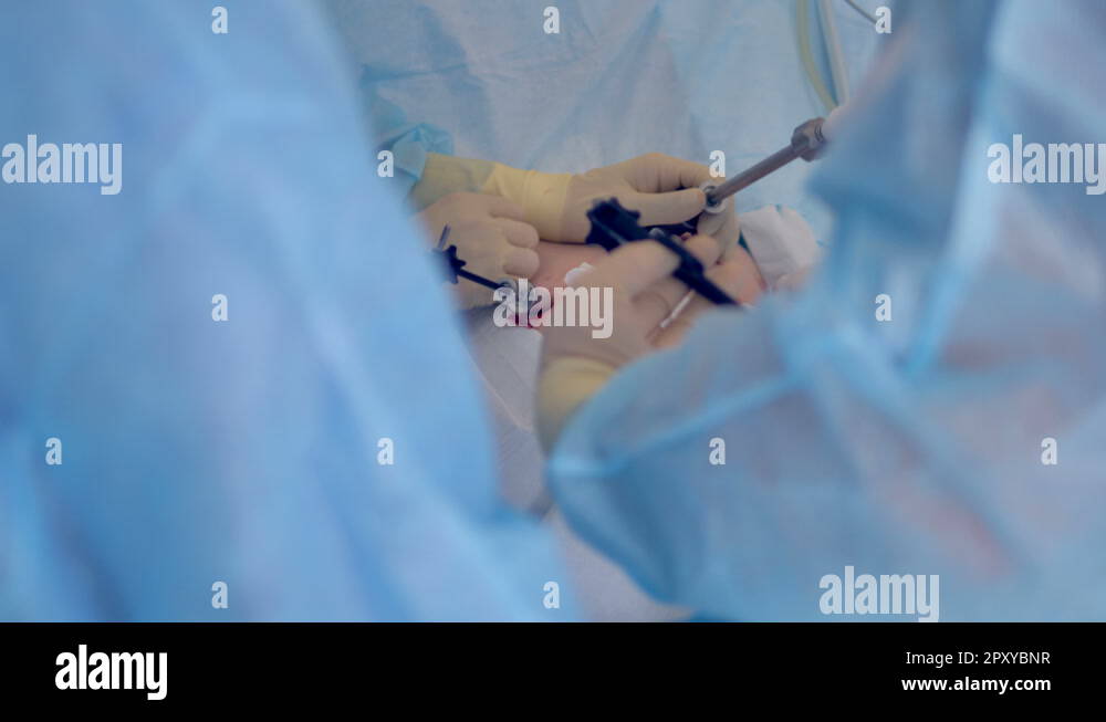 Suture technique Stock Videos & Footage - HD and 4K Video Clips - Alamy