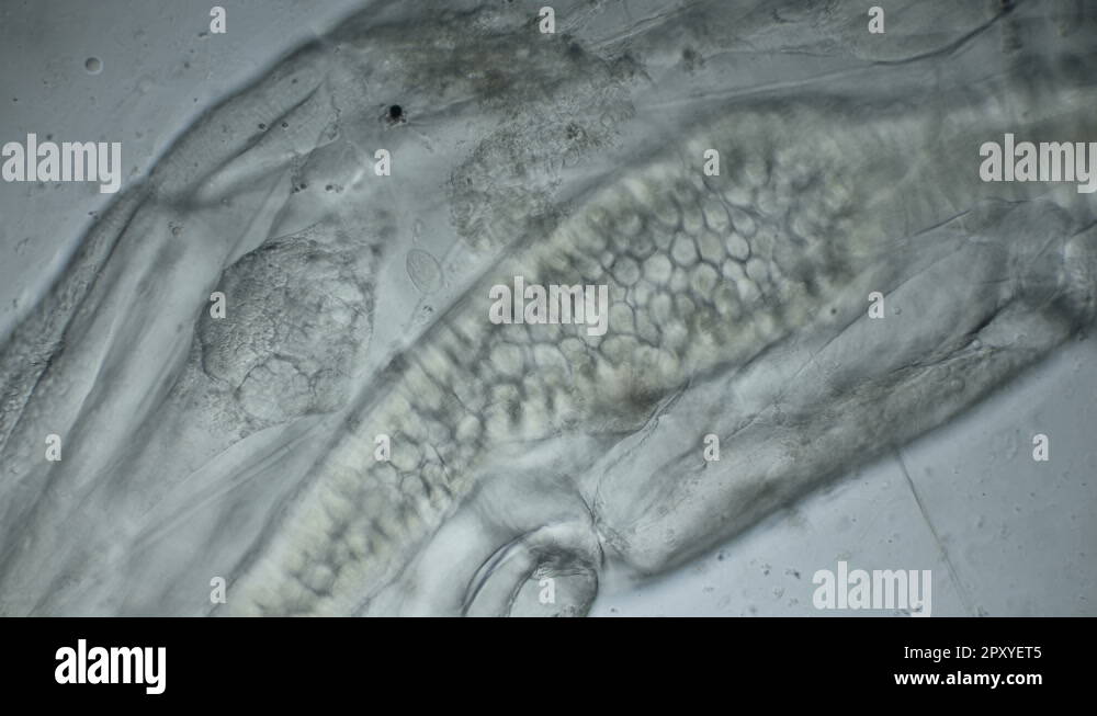 a transparent larva under the microscope,with internal organs,like an ...