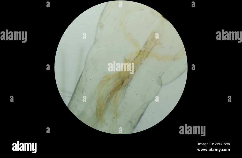 a transparent larva under the microscope,with internal organs,like an ...