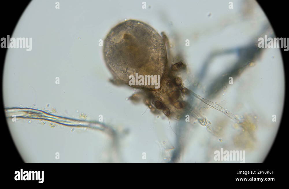 dead dust mite became the habitat of microorganisms, under a microscope ...