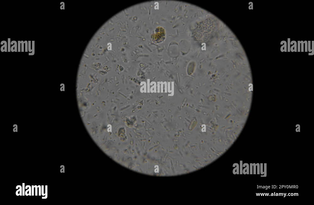 Tests a sample Stock Videos & Footage - HD and 4K Video Clips - Alamy