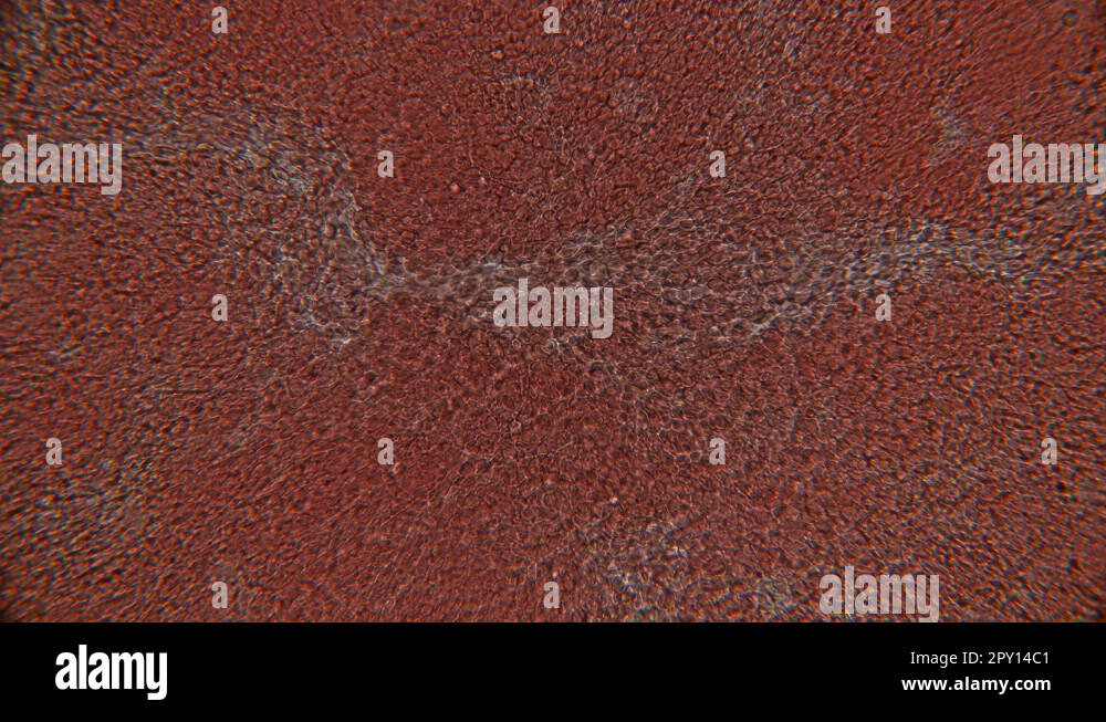 Blood serum antibodies Stock Videos & Footage - HD and 4K Video Clips ...