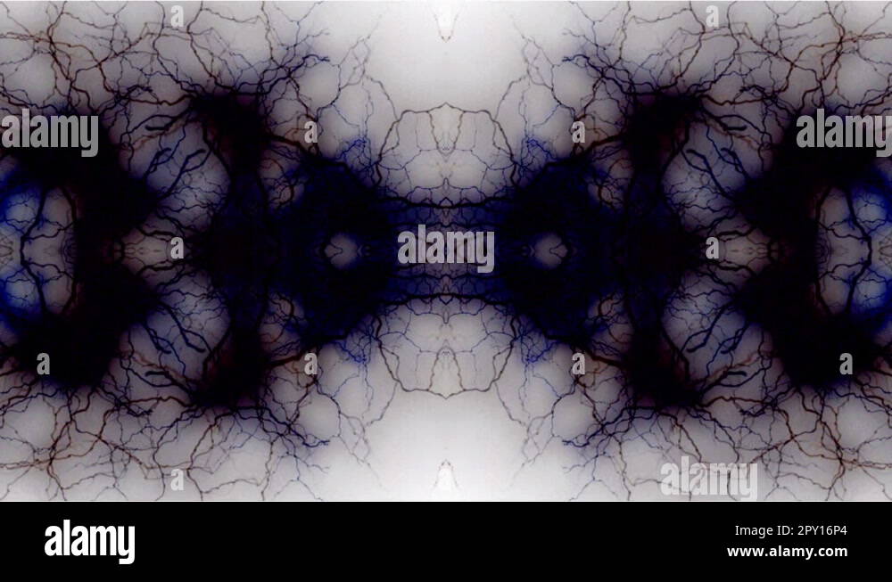 fiber and antenna,cell division under microscope,plastic,colloid,ghost ...
