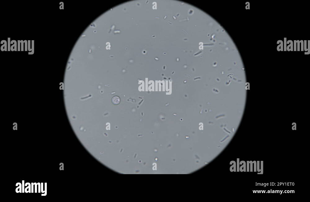 Syphilis bacteria Stock Videos & Footage - HD and 4K Video Clips - Alamy