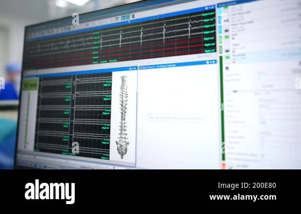 Wide screen of a computer with brain waves and image of a spine. Close ...