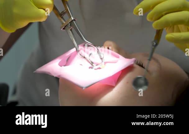 Dentist, hands and mirror in mouth for consultation, patient ...