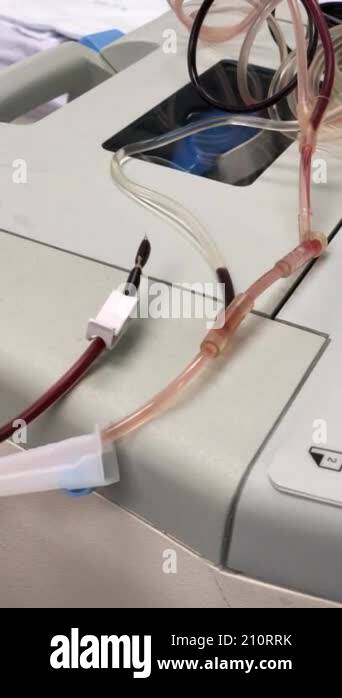 Blood platelet donation Machine is working, it draws blood from arm for ...