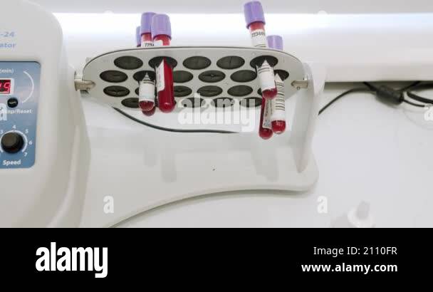 The blood is mixed in the laboratory. Tubes of blood are rotated in the ...