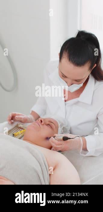 Peeling, woman health care, skin regeneration, dermapen microneedling ...