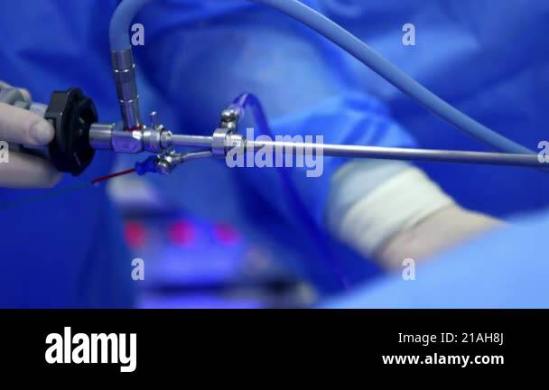 Doctor's hands in latex gloves apply modern endoscopic tool at ...