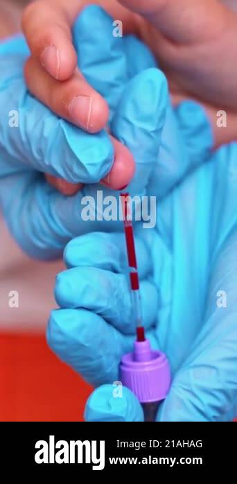 Medical worker taking blood sample. Hands in blue sterile gloves ...