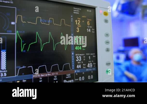 Monitor of the modern lung ventilator. Life signs of the patient under ...