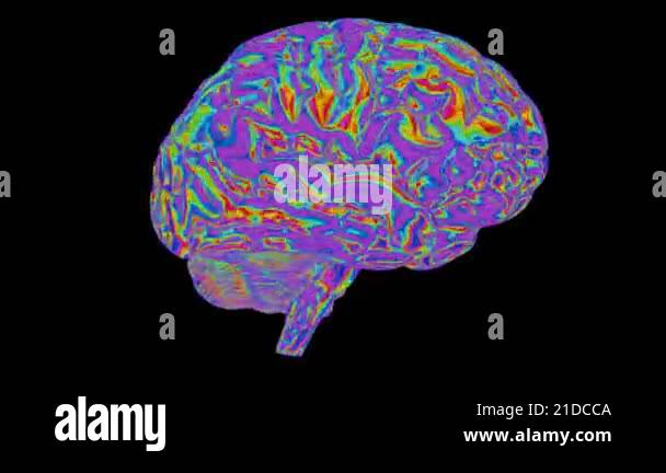 Psychedelic Brain Illustration with Vibrant Abstract Patterns Stock ...