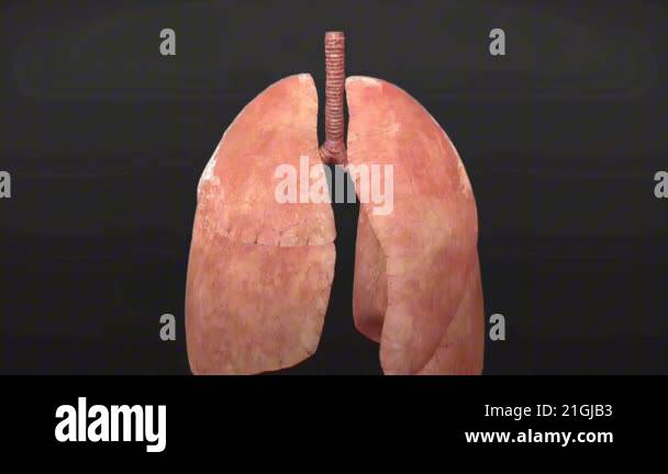 Normal lungs Stock Videos & Footage - HD and 4K Video Clips - Alamy
