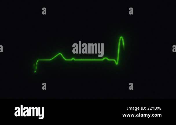 Cardiogram EKG ECG signal. Heart beat wave, pulse rhythm Stock Video ...