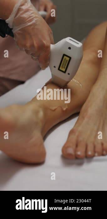 Diode laser hair removal on female legs for smooth skin, beautician ...