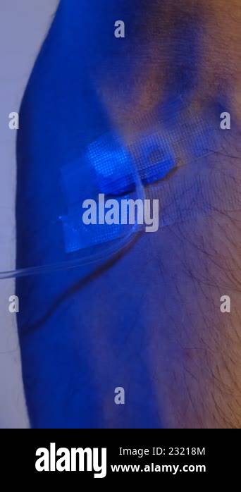 The image of serum attached to the arm in blue light, intravenous drug ...