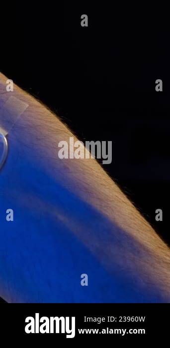 The image of serum attached to the arm in blue light, intravenous drug ...