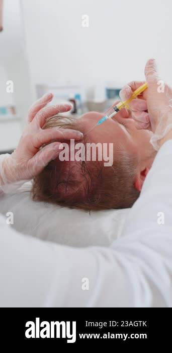 Alopecia. Man hair loss treatment regeneration. Trichologist ...